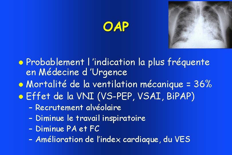 Ventilation Non Invasive aux urgences Dominique Pateron SAU