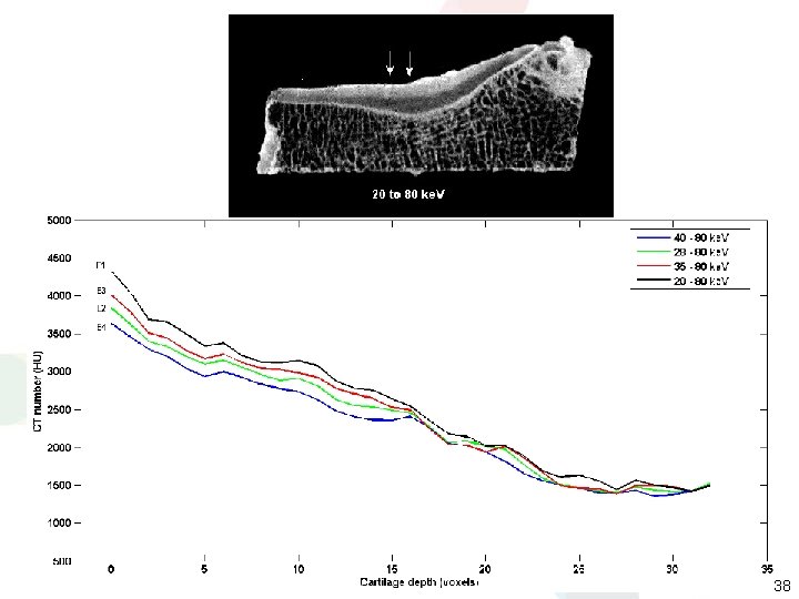 Orthopaedic applications of MARS spectral CT Kishore Rajendran