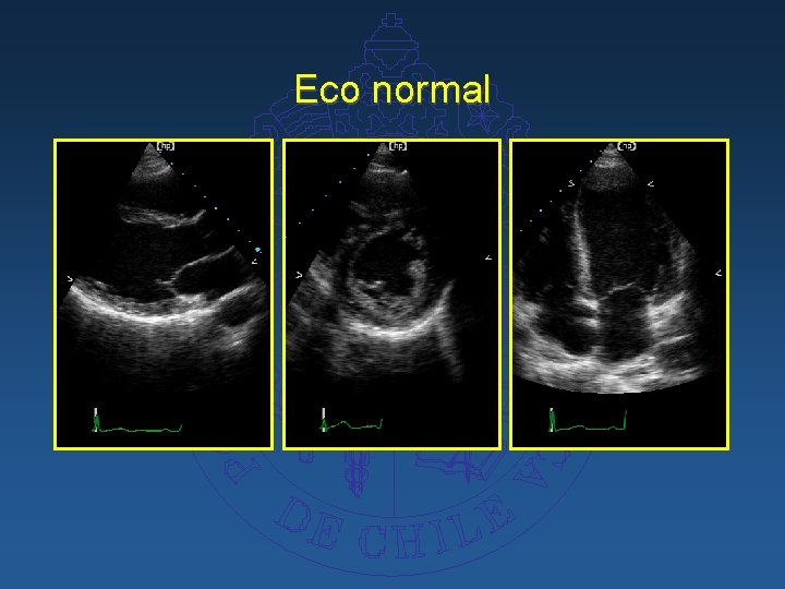 ECOCARDIOGRAFIA Preguntas Qu es un ecocardiograma Modalidades del