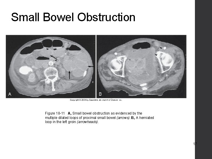 CT of the Body and Special CT Procedures