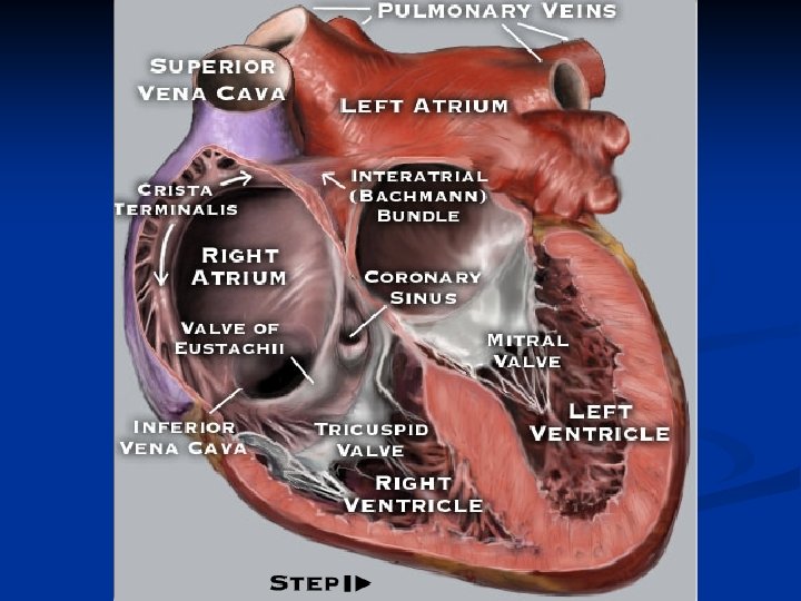 ECG 101 Narrow Complex Tachycardia Scott E Ewing