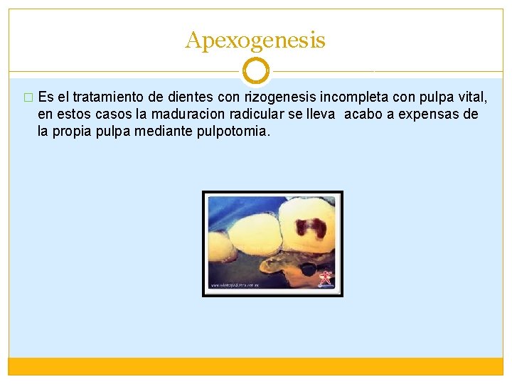 APEXOGENESIS ENDODONCIA DRA VERENA MORALES Introduccion Los terminos