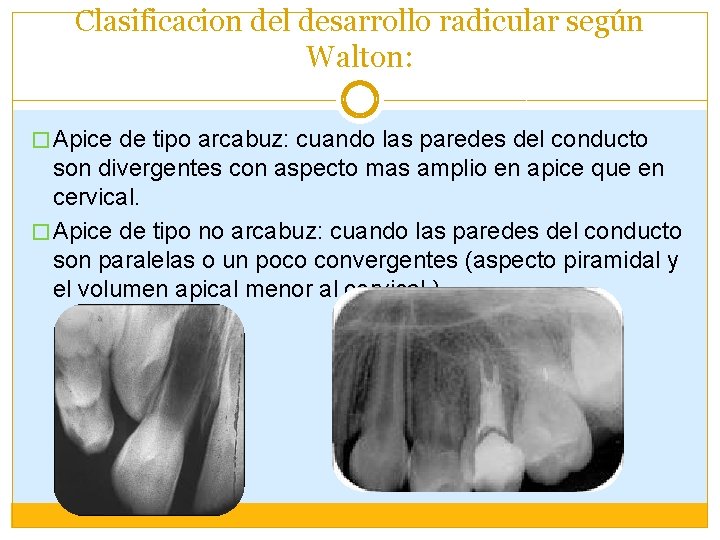 APEXOGENESIS ENDODONCIA DRA VERENA MORALES Introduccion Los terminos