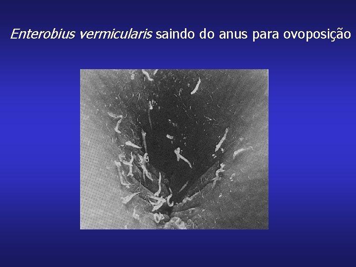 Platyhelminthes Trematoda Eucestoda Aschelminthes Nematoda Taxonomia ...