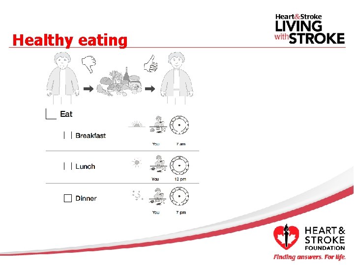 Swallowing and Nutrition Topics Module 1 Understanding stroke