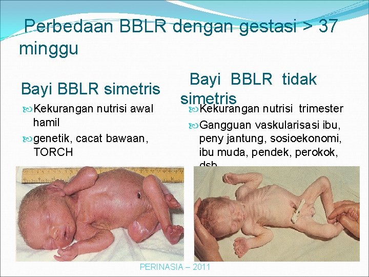 Permasalahan Bayi Berat lahir Rendah Pelatihan Penatalaksanaan BBLR