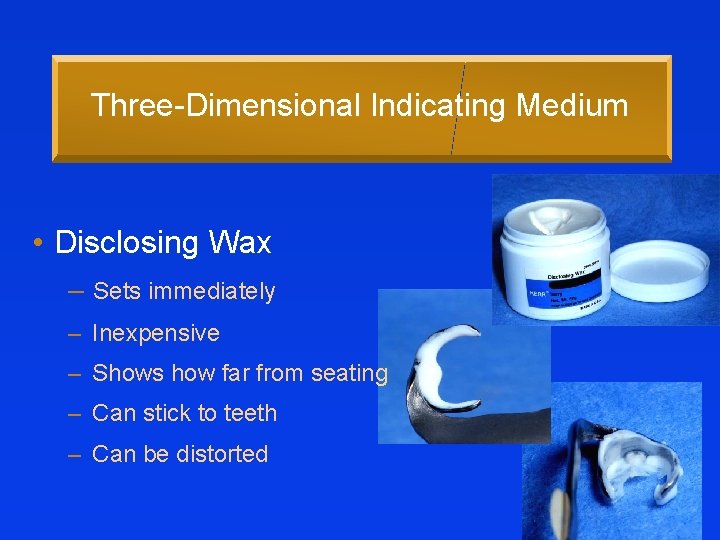 Removable Partial Denture Framework Adjustment Rudd Kuebker 75