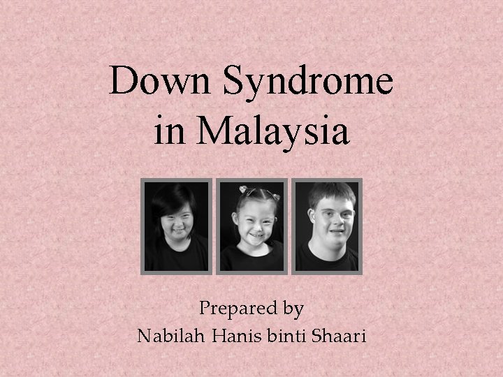 Down Syndrome in Malaysia Prepared by Nabilah Hanis
