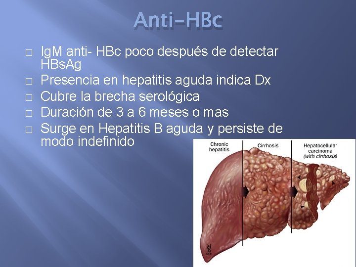 HEPATITIS B Virus de la hepatitis B VHB