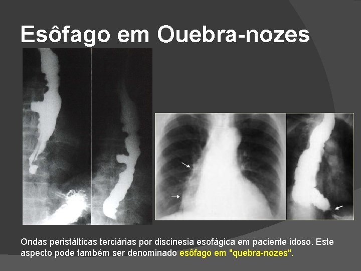 ESFAGO E ESTMAGO DR ANDR SPENZIERI C DE