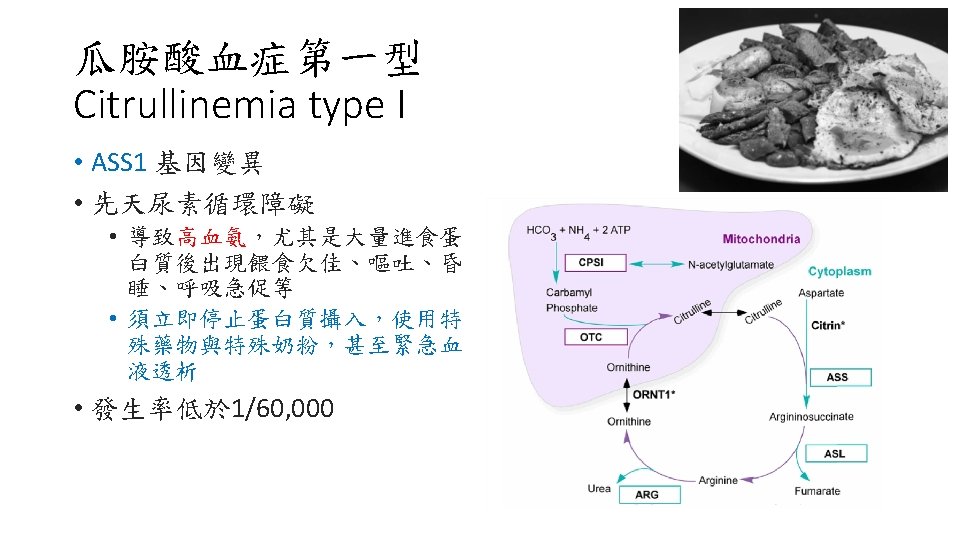 Citrullinemia type II Citrin neonatal intrahepatic cholestasis caused