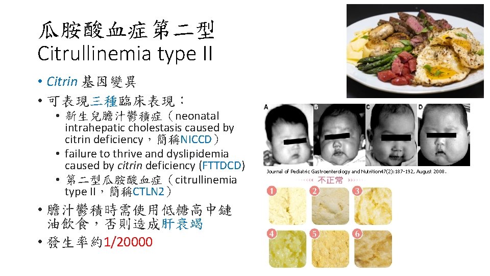 Citrullinemia type II Citrin neonatal intrahepatic cholestasis caused