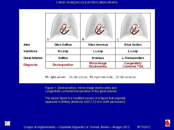 Roberto Pirola Corso avanzato di elettrocardiografia ECG 28
