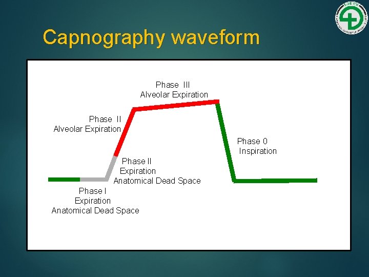 Capnography in prehospital care Picture space central BASICS