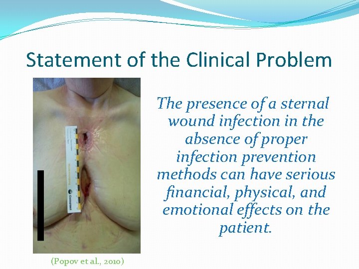 Theory Guiding Practice Preventing Sternal Wound Infections Marissa