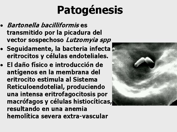 Bartonelosis humana por Bartonella bacilliformis Csar Henrquez 1