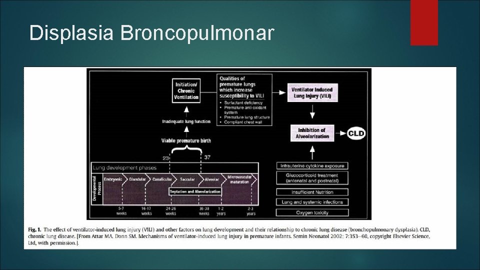UTI Neonatal HMIB Displasia broncopulmonar Mitos do manejo