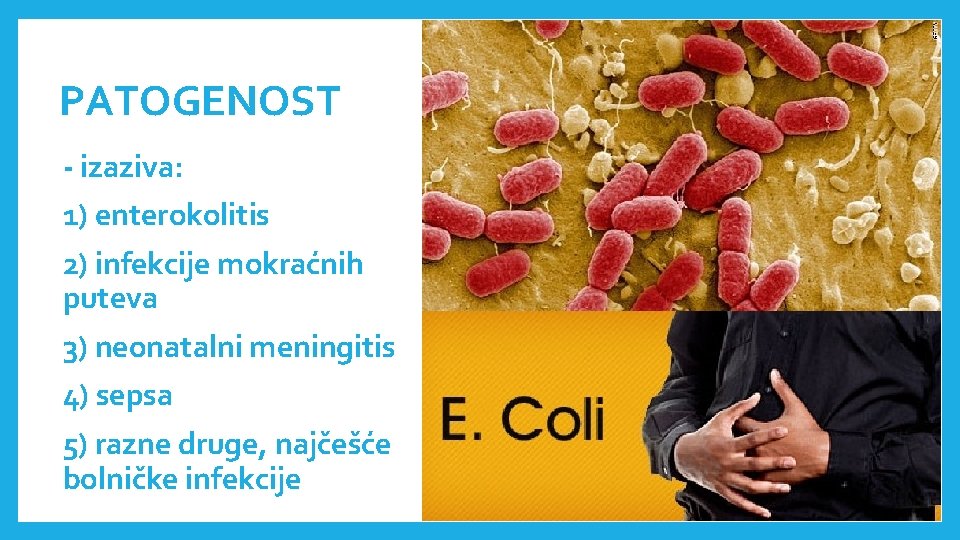 9 GRAMNEGATIVNE TAPIASTE BAKTERIJE ESCHERICHIA COLI Medicinska kola