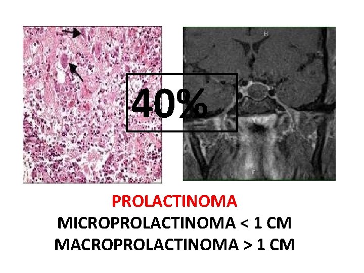 ENDOCRINOLOGIA DIAGNOSTICA DRA LORENA VALERDI CONTRERAS DEFINICION DE
