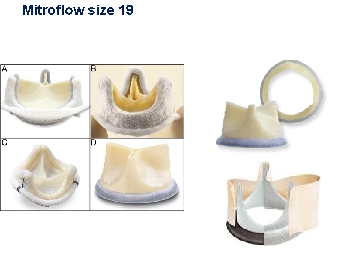 PORTICO Lessons Learnt From the Clinical Trials Ganesh