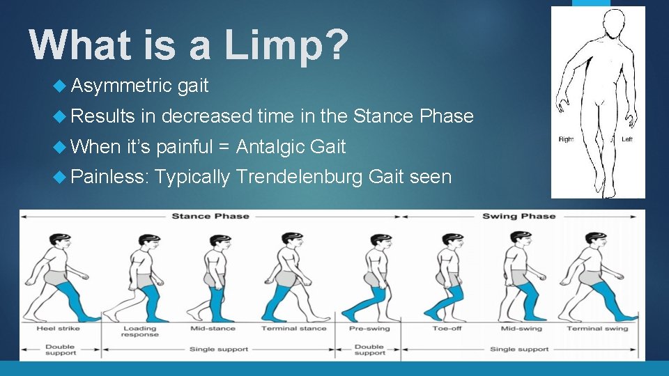 The Limping Child The good bad and do
