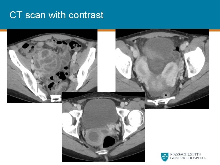 Case Presentation NEW ENGLAND SOCIETY OF INTERVENTIONAL RADIOLOGY