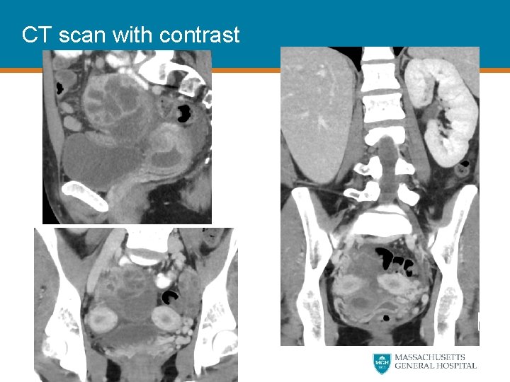 Case Presentation NEW ENGLAND SOCIETY OF INTERVENTIONAL RADIOLOGY