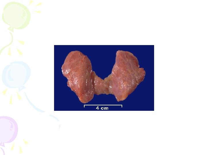 The Endocrine system for dental students DR IBRAHIM