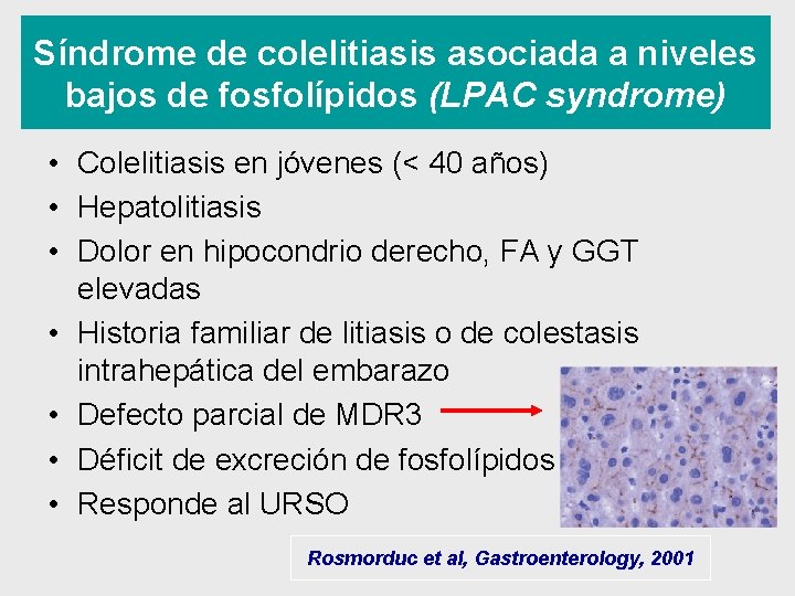 Colestasis congnitas por defectos en las protenas transportadoras