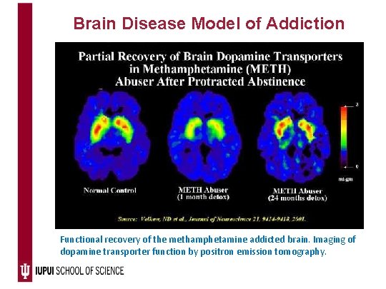 Drugs Brain and Behavior The Neuroscience of Addiction