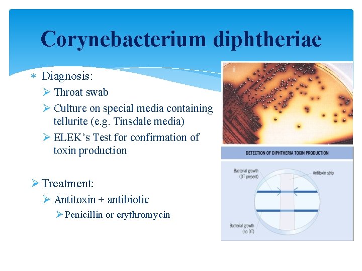 Bacterial Upper Respiratory Tract Infections URTI Dr Khalifa