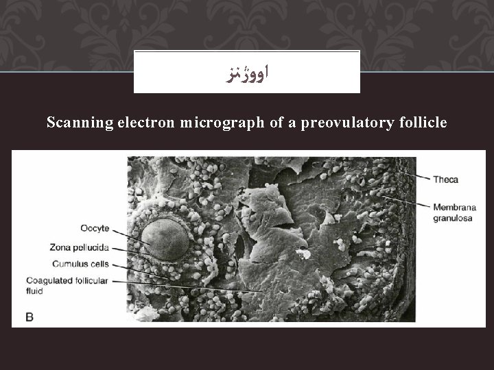 Scanning electron micrograph of a preovulatory follicle Scanning