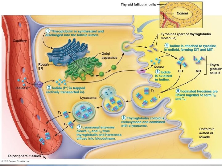Is it true Hemi thyroidectomy Partial thyroidectomy Subtotal