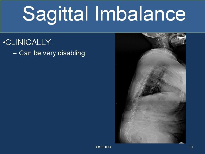 1 Key measurements for understanding spinal deformity Greg