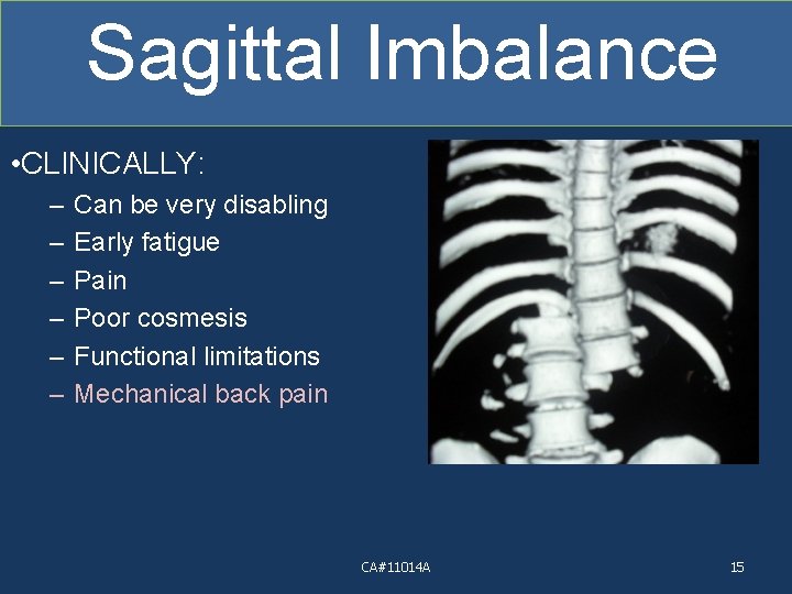 1 Key measurements for understanding spinal deformity Greg