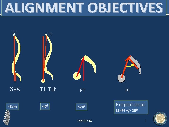 1 Key measurements for understanding spinal deformity Greg