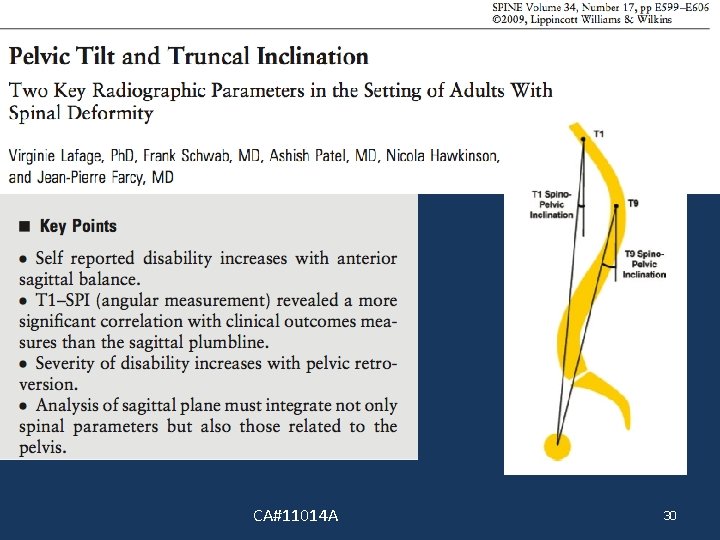 1 Key measurements for understanding spinal deformity Greg