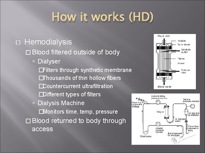 DIALYSIS TREATMENT FOR KIDNEY DISEASE By Zachary Jacobson