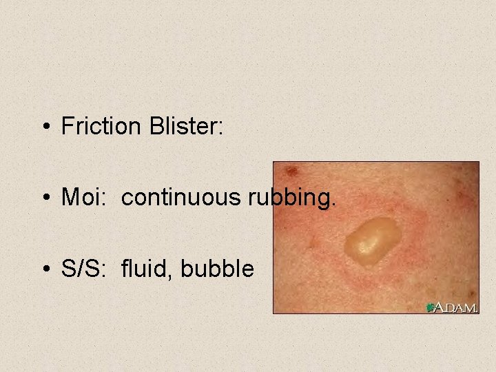 Mechanisms Soft Tissue Trauma Critical Thinking A baseball