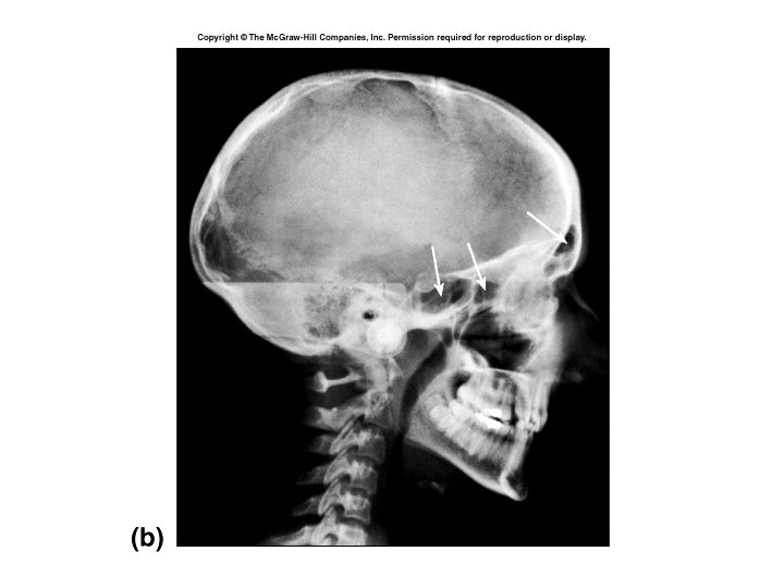 Respiratory System Exercises 36 and 37 1 Respiration
