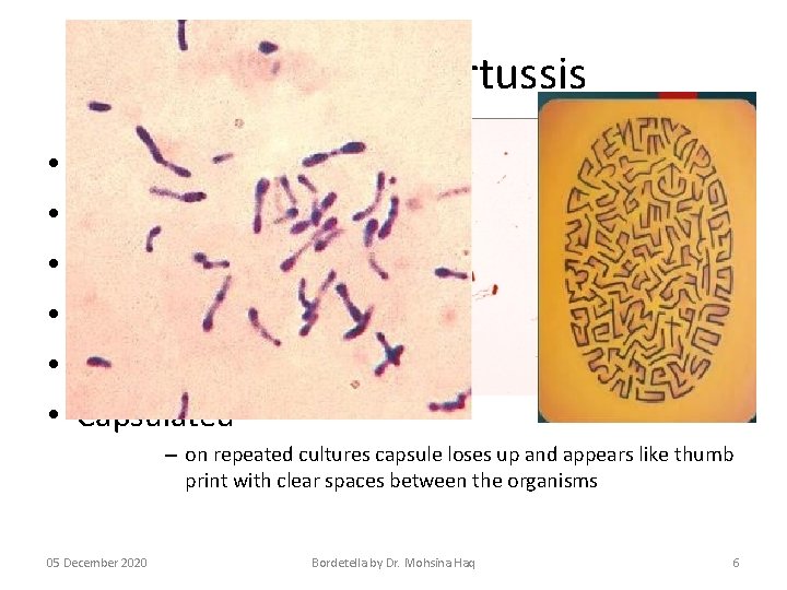 Bordetella Dr Mohsina Haq Classification Genus Bordetella B