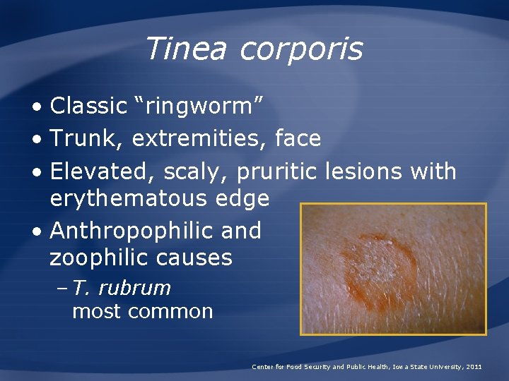 Dermatophytosis Ringworm Tinea Dermatomycosis Overview Organisms ...