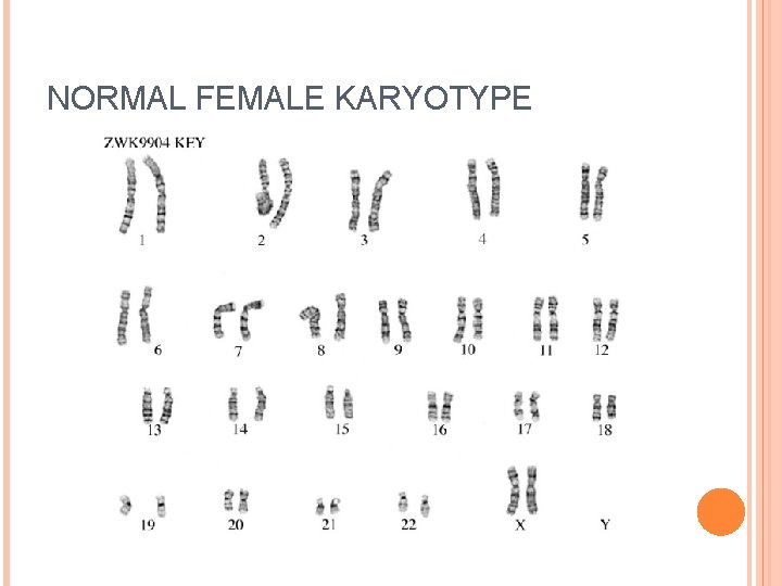 KARYOTYPES A picture of chromosomes arranged by size