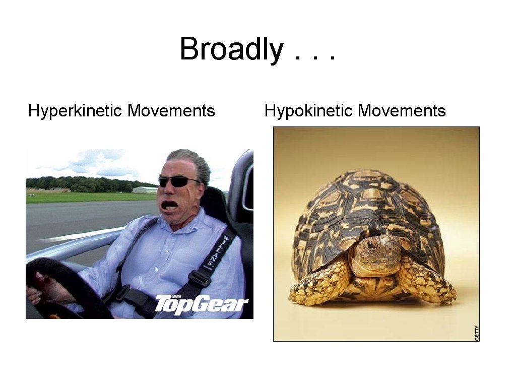 An Approach to Movement Disorders Mc Gill Neurology