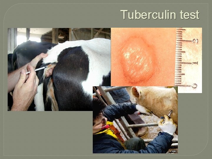 Tuberculosis Maxs U E Sanam Tuberculosis TB adalah