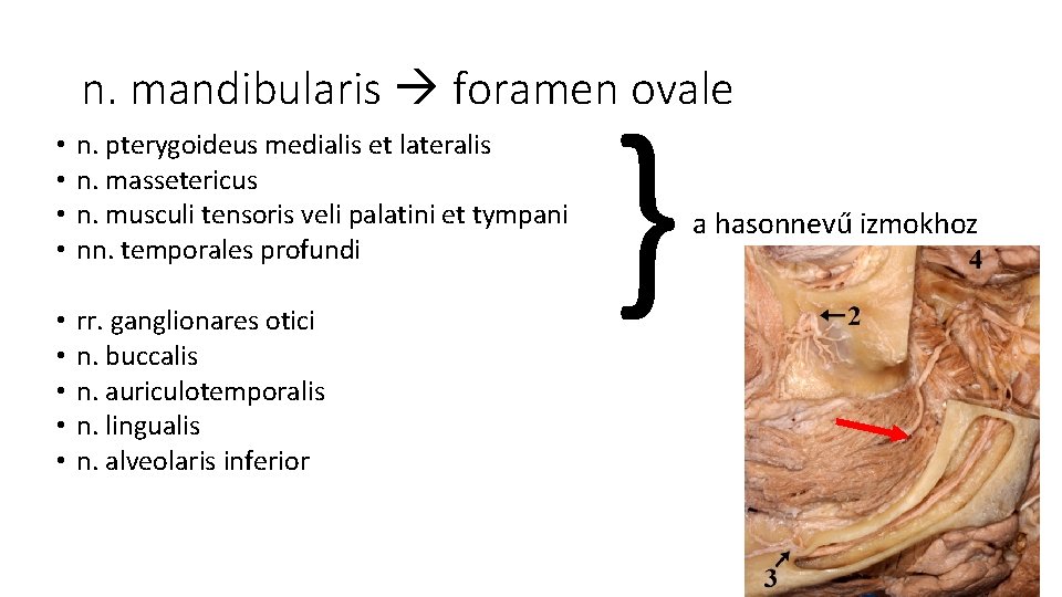Nervus trigeminus Trigeminus neuralgia OK 2018 10 24