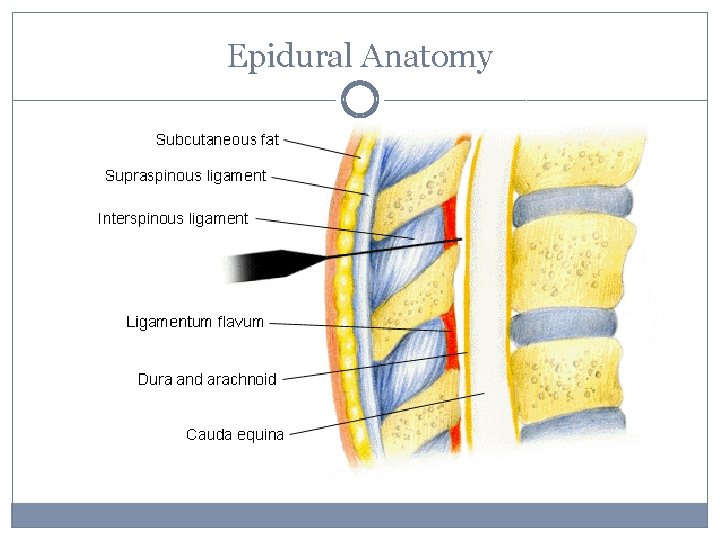 Mechanisms and Management of an Incomplete Epidural Block