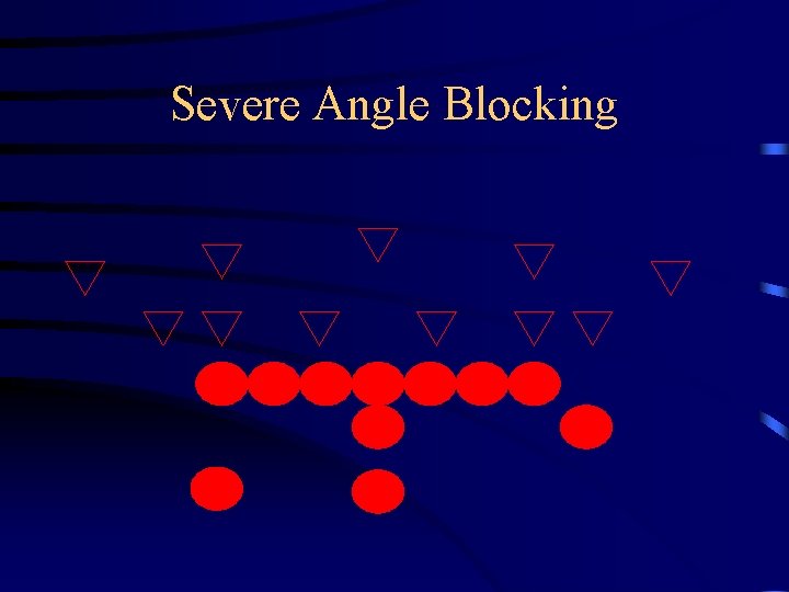 Severe Angle Blocking Severe Angle Blocking Severe Angle