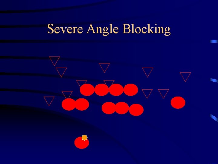 Severe Angle Blocking Severe Angle Blocking Severe Angle