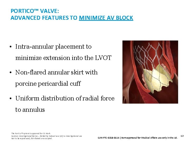 2018 GLOBAL PORTICO PROGRAM UPDATE Portico Transcatheter Aortic